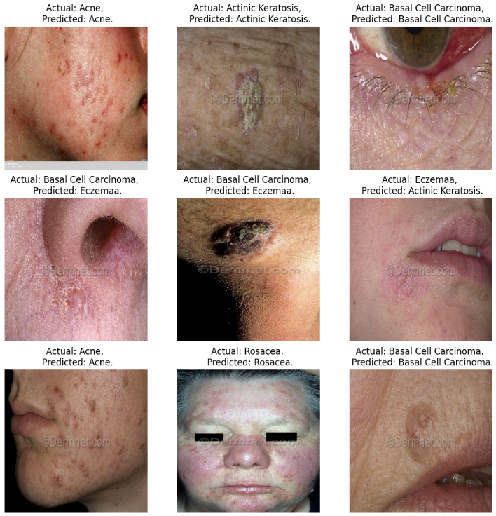 Deep Learning Projects | Stanley Armando Austen